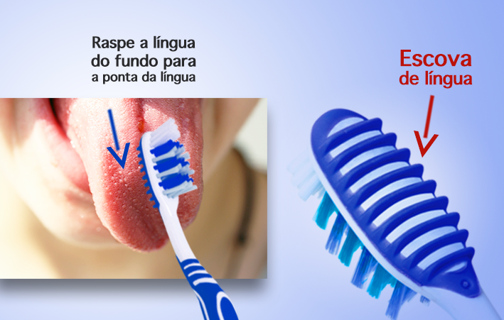 Saúde Bucal: Saburra Lingual | Viva Melhor Online